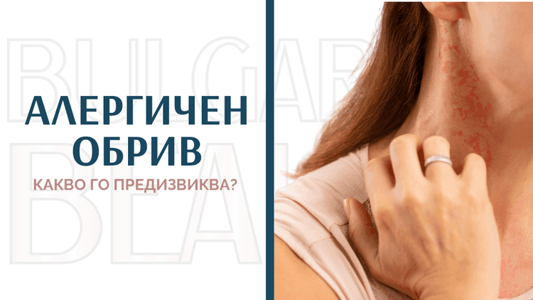 Алергичен обрив Що е то и какво го предизвиква